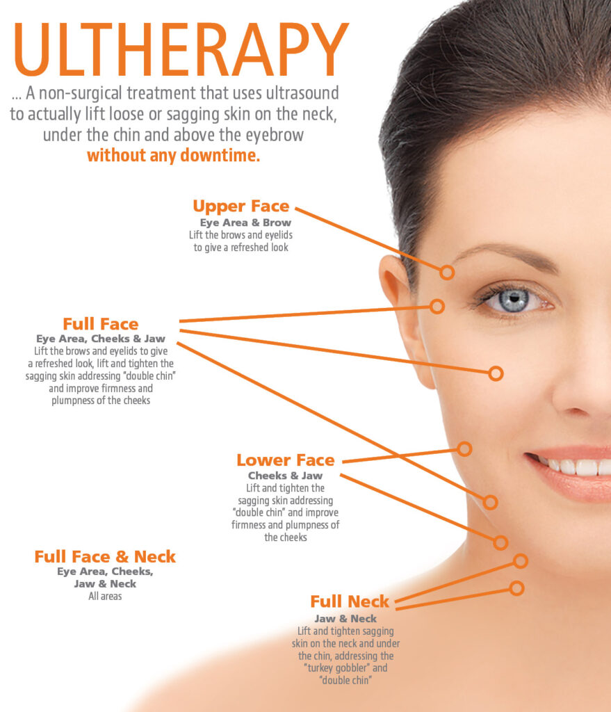 ULTHERAPY – Helena Sir Beauty Oficial